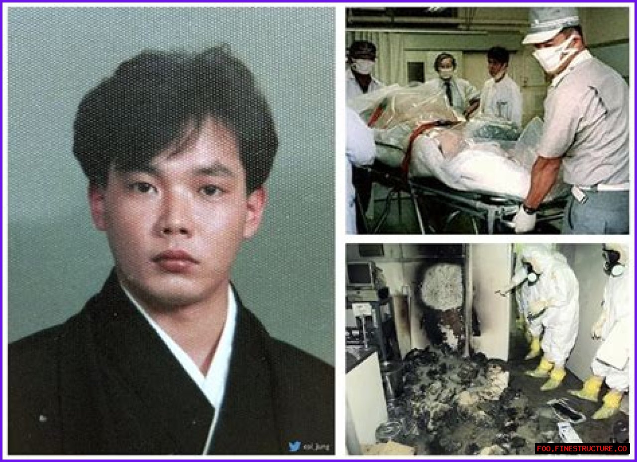 Unveiling The Story Of Hisashi Ouchi And His Skin Grafts